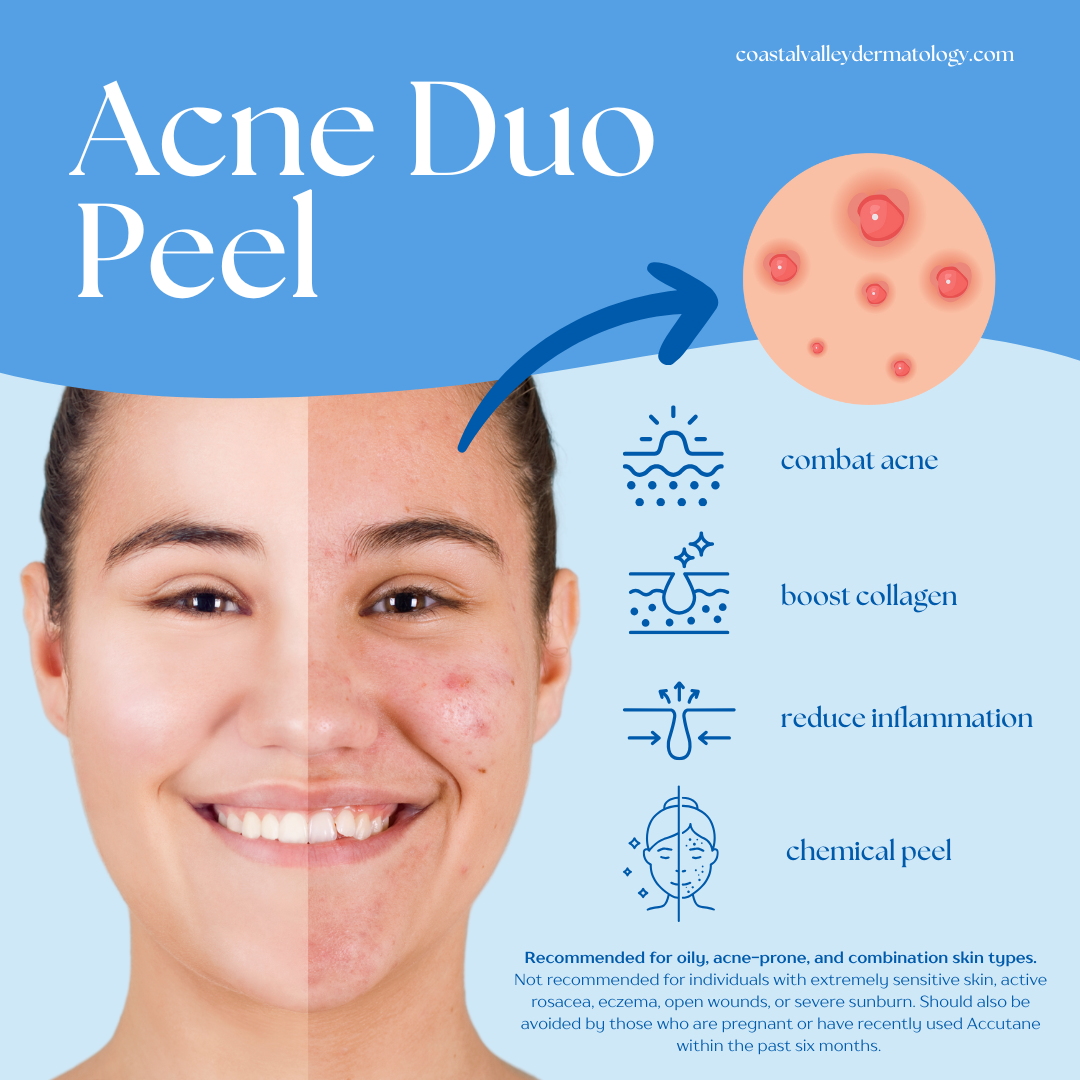 Acne Duo Peel – Coastal Valley Dermatology